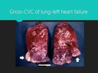 Oedema and hyperemia | PPTX