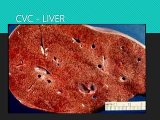 Oedema and hyperemia | PPTX