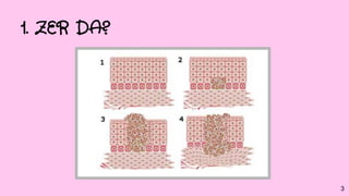 Ugatz minbizia pp | PDF