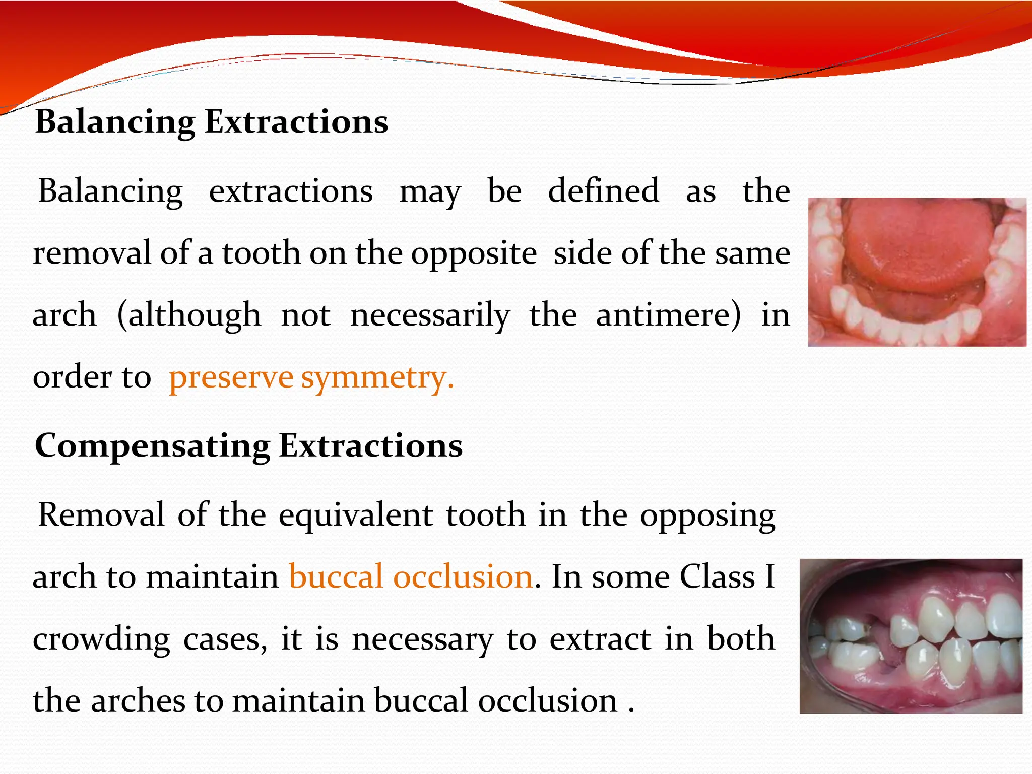 UG CLASS EXTRACTION IN ORTHODONTICS.pptx