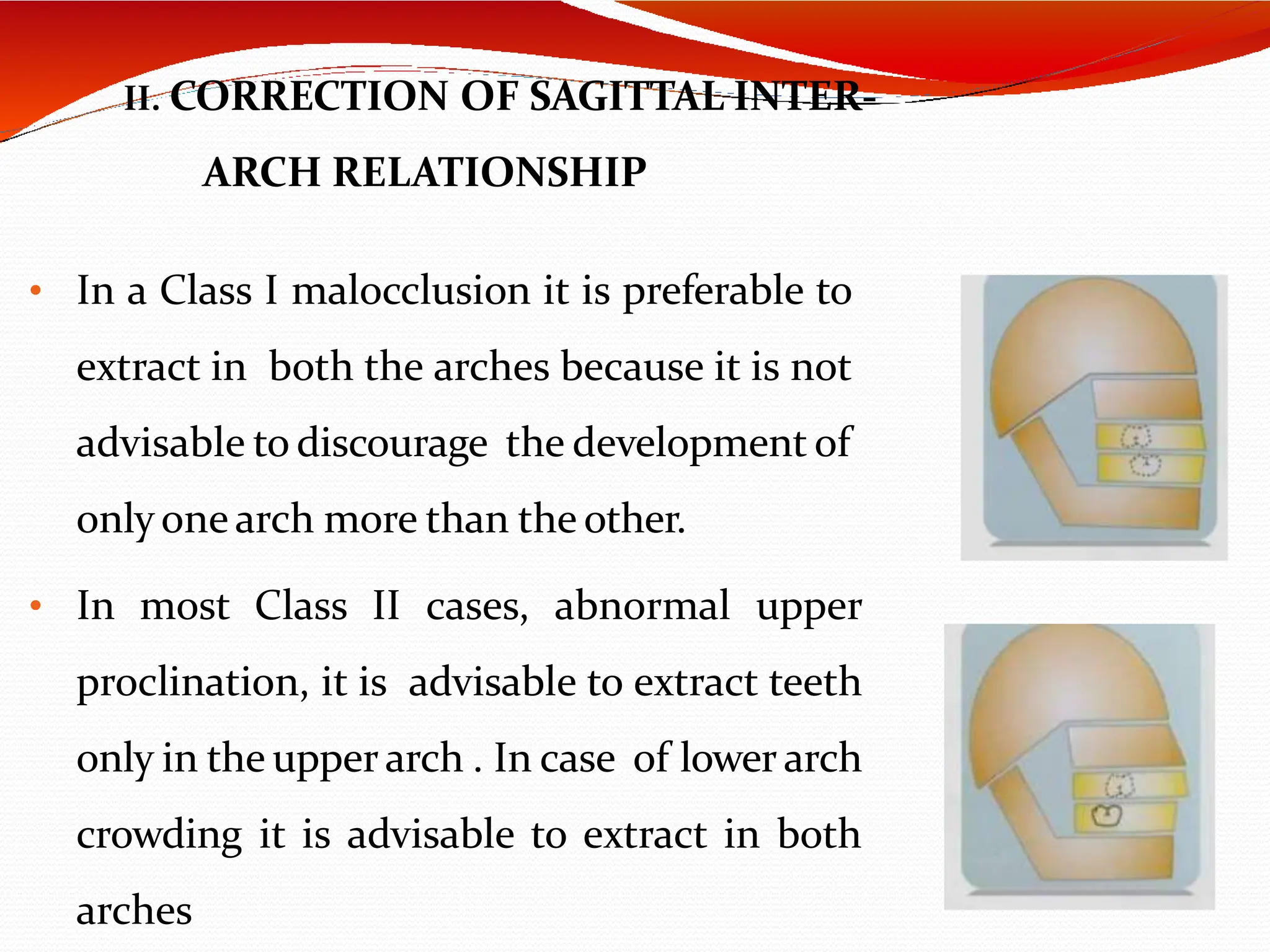 UG CLASS EXTRACTION IN ORTHODONTICS.pptx
