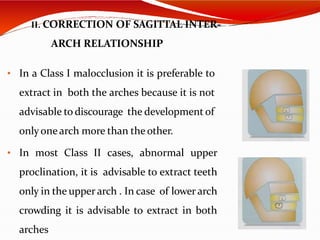 UG CLASS EXTRACTION IN ORTHODONTICS.pptx
