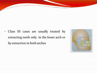 UG CLASS EXTRACTION IN ORTHODONTICS.pptx