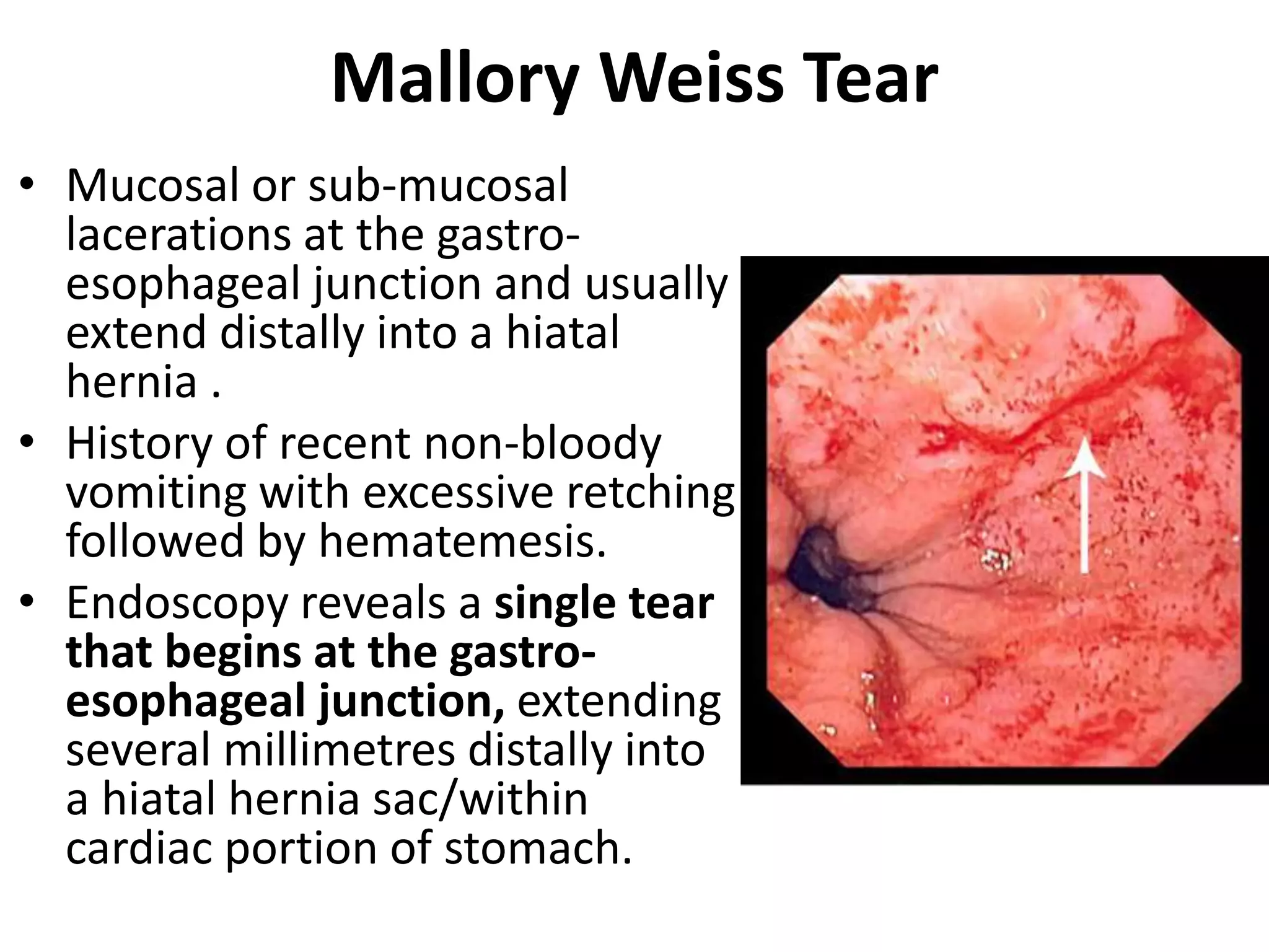 UGIB - ppt 2023.pptx