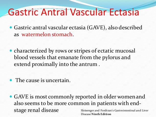 upper G I Bleed (non variceal)