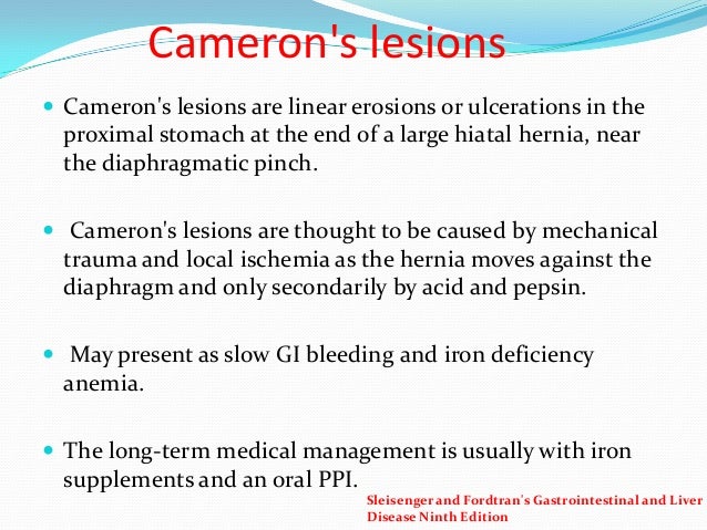upper G I Bleed (non variceal)