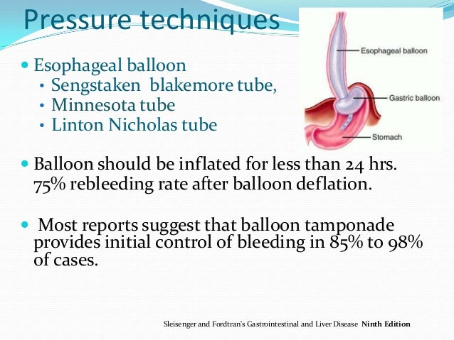 upper G I Bleed (non variceal)