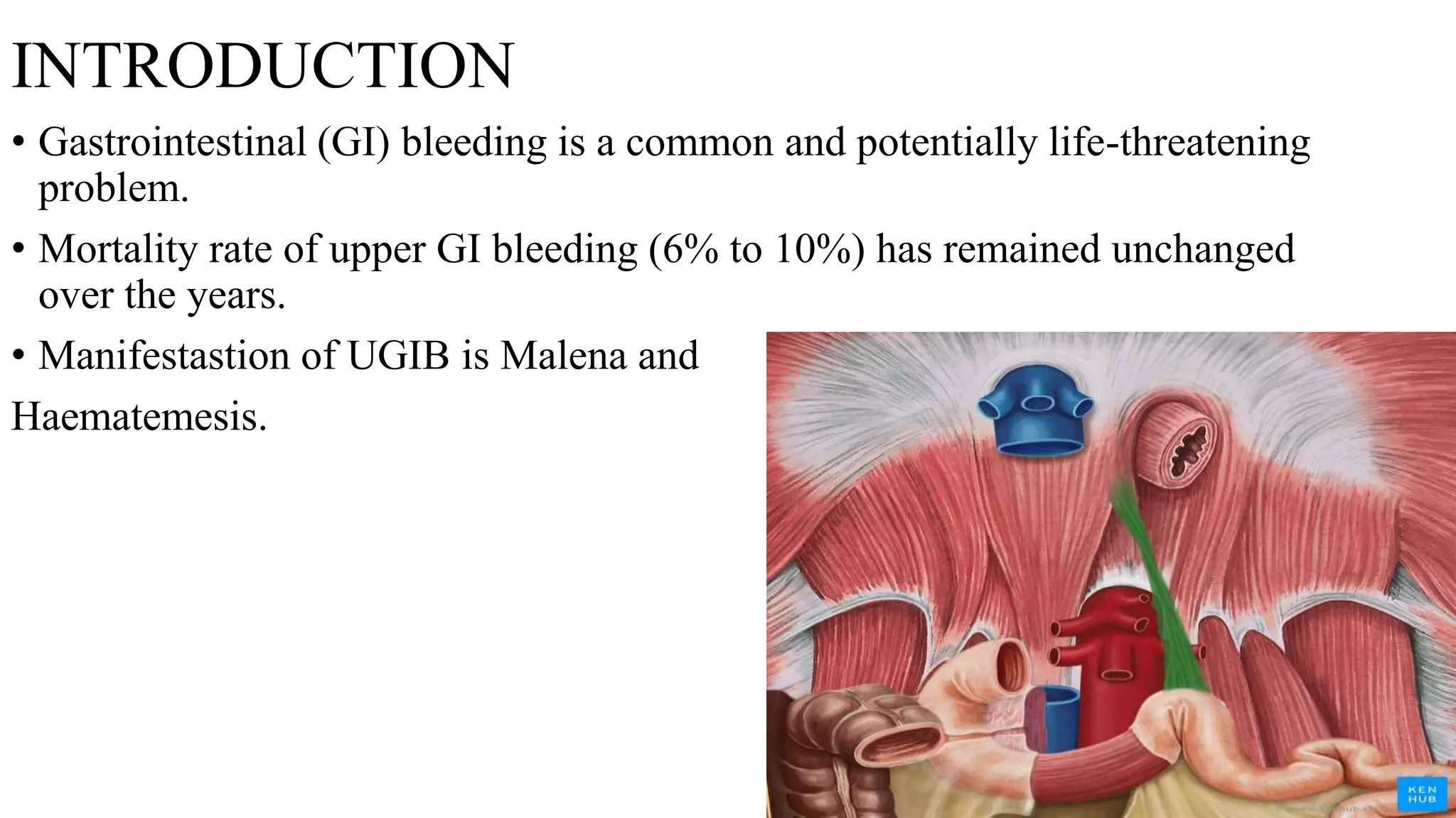 UGI BLEED SEMINAR.pptx