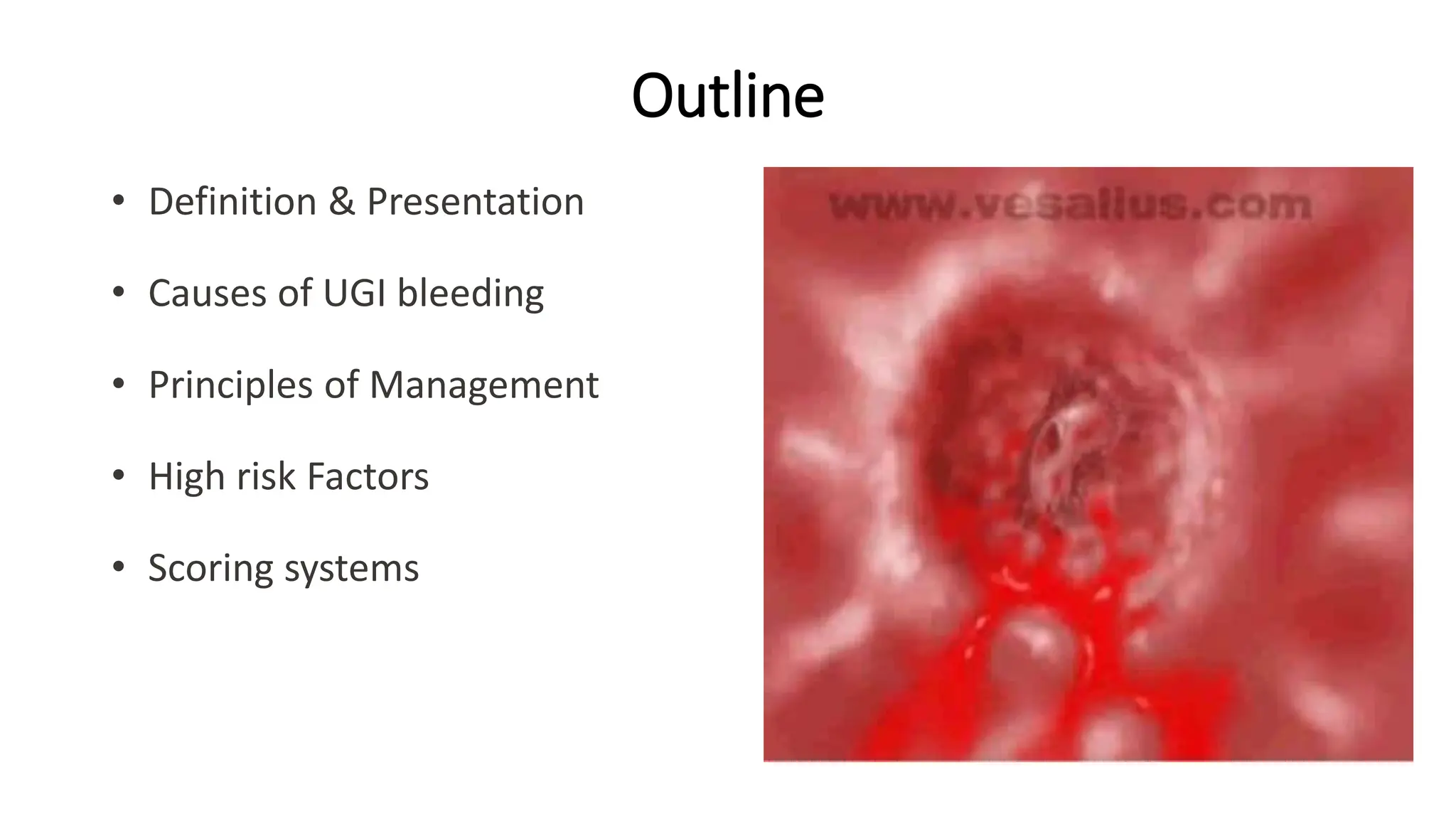Upper GI bleeding (UGIB) Lecture Ppt.pptx