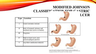 UGI for MBBS 3 guide to history, examination and acute management | PPT