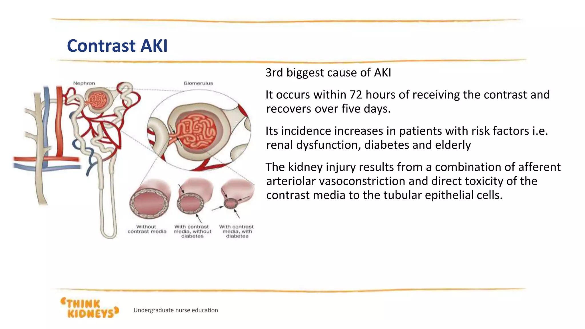 Undergraduate Nurses AKI Year Two | PPTX