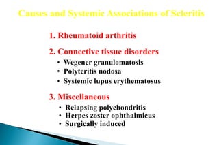 SCLERITIS | PPT