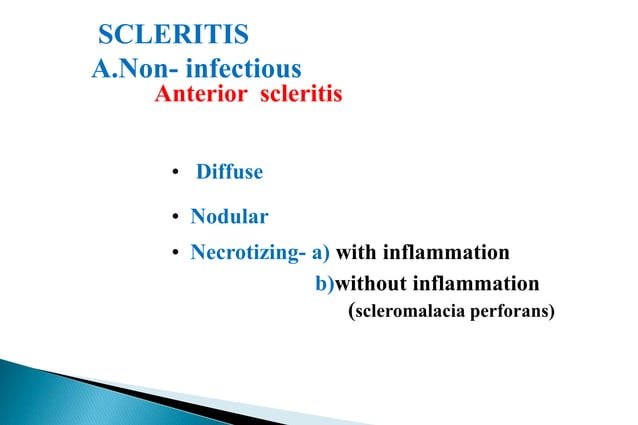 SCLERITIS | PPT