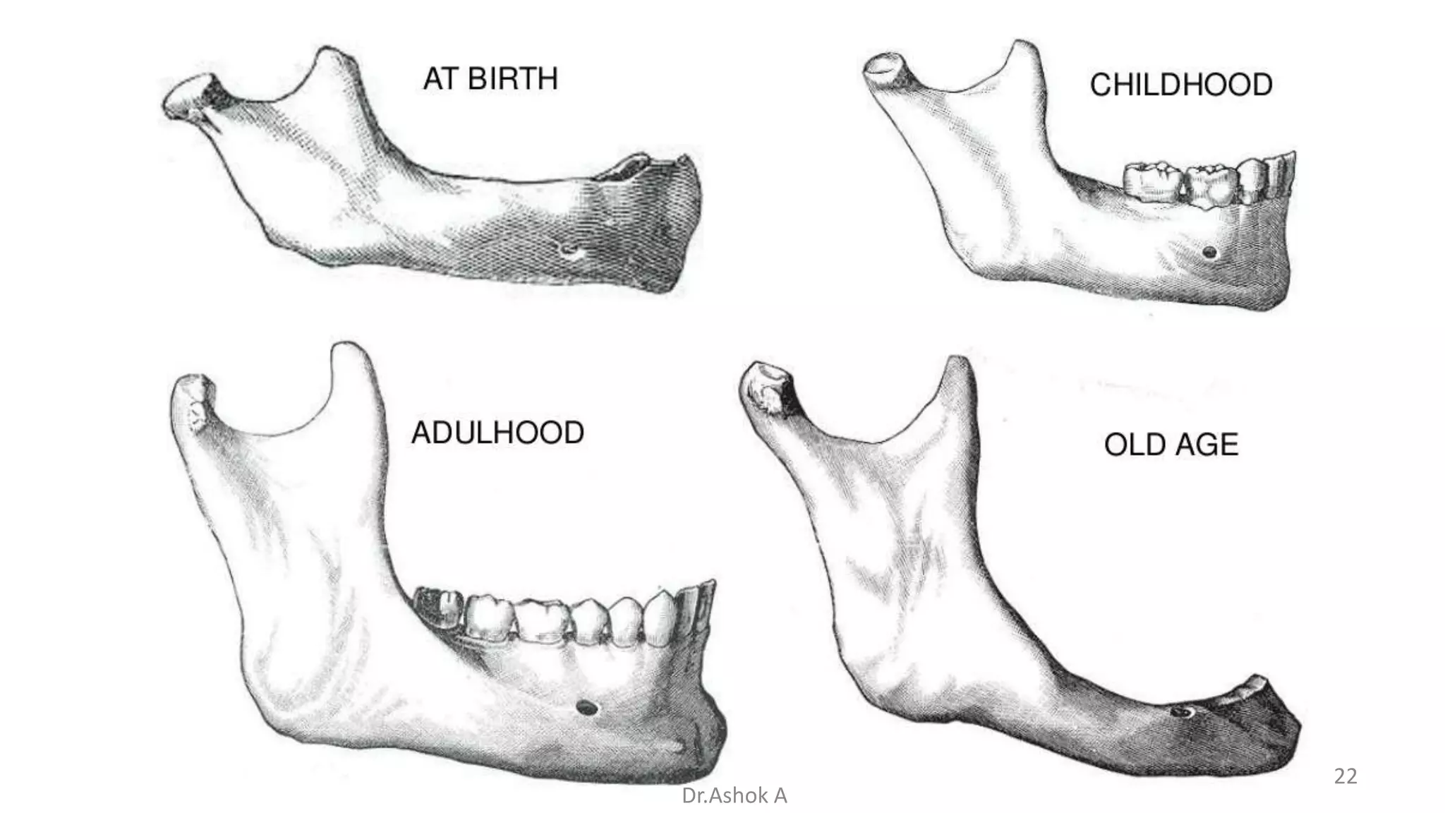 Postnatal growth of maxilla & mandible | PPTX
