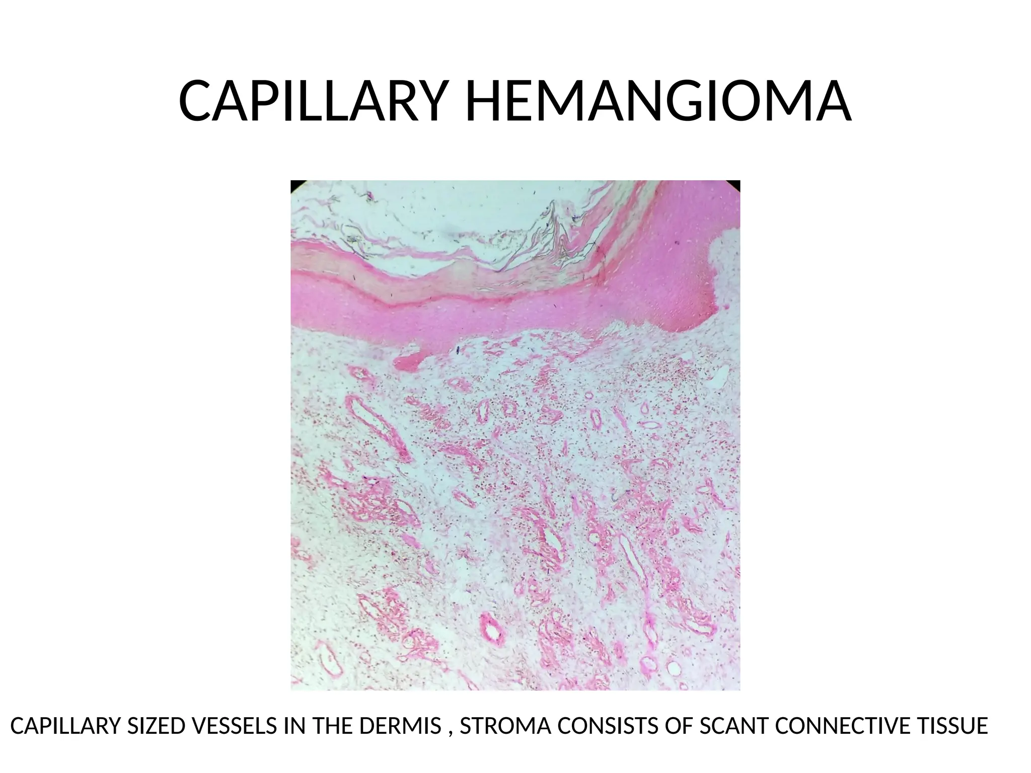 UG histopathology SLIDES presentation.pptx