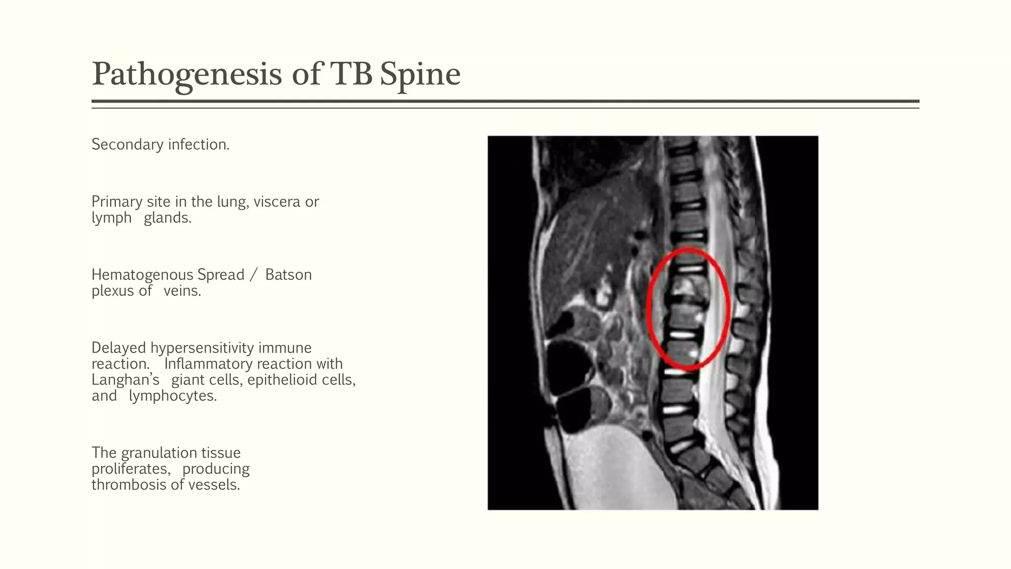 tuberculosis of the skeletal system | PPTX | Bone and Joint Conditions ...