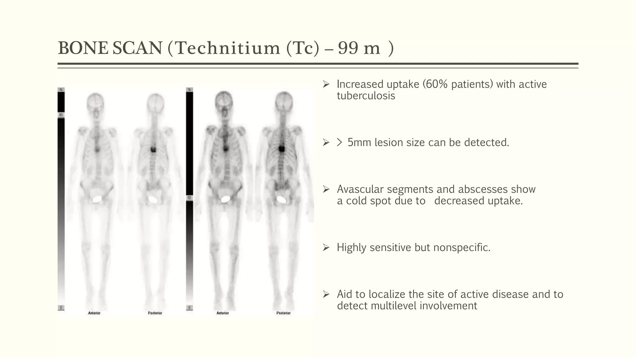 tuberculosis of the skeletal system | PPTX
