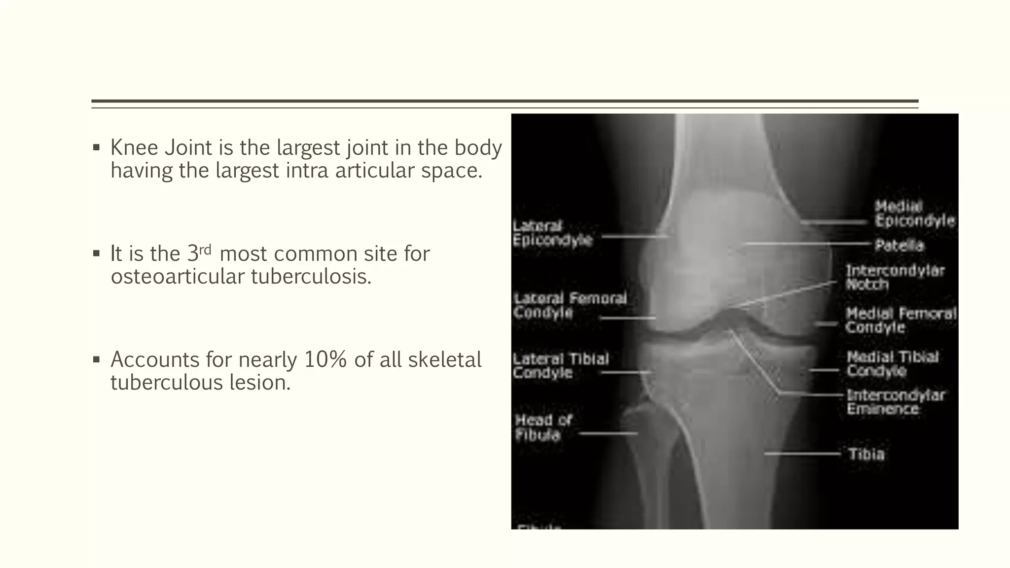 tuberculosis of the skeletal system | PPTX | Bone and Joint Conditions ...