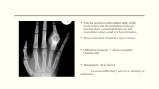 tuberculosis of the skeletal system | PPTX