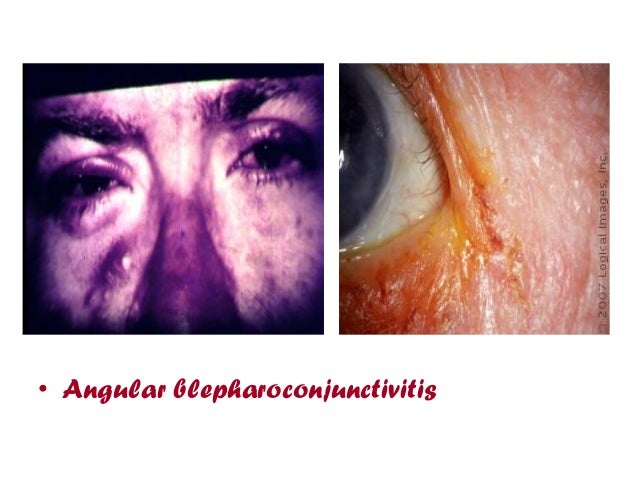 Uhs all past eye ospes