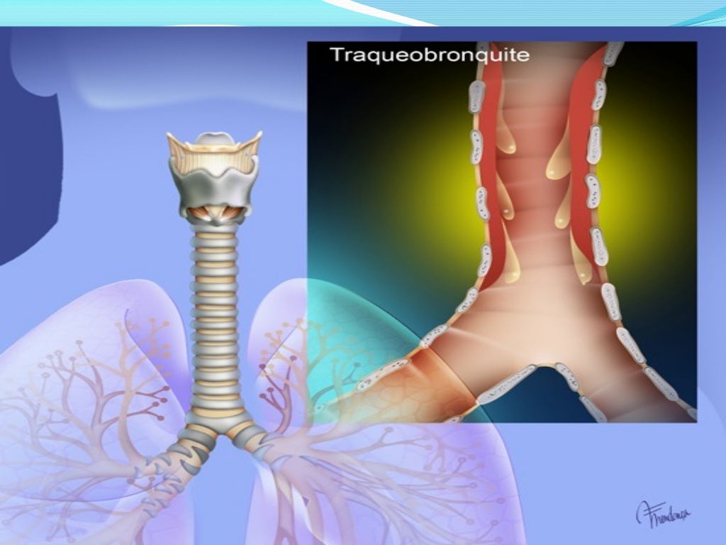 Tosse e expectoração