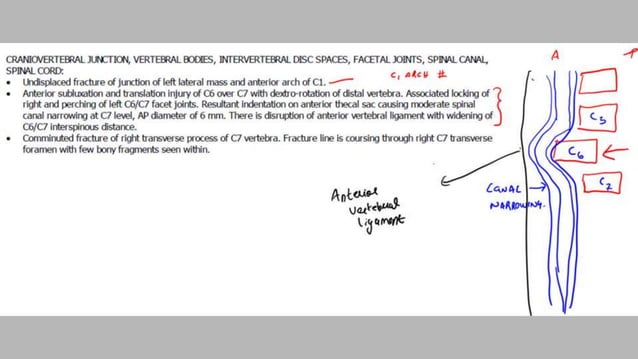 CNS_Case_9_Spinal_cord_.pptx