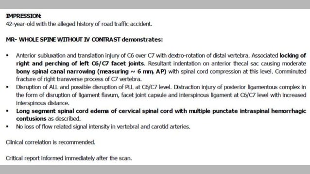 CNS_Case_9_Spinal_cord_.pptx
