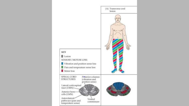 CNS_Case_9_Spinal_cord_.pptx