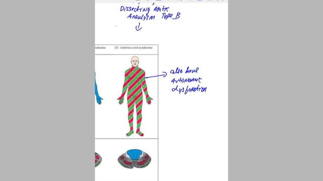 CNS_Case_9_Spinal_cord_.pptx