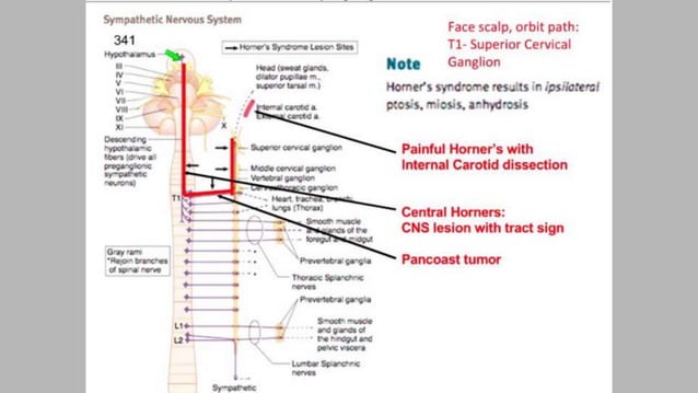 CNS_Case_9_Spinal_cord_.pptx