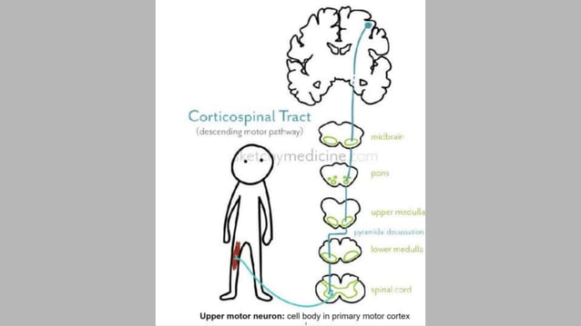 CNS_Case_9_Spinal_cord_.pptx