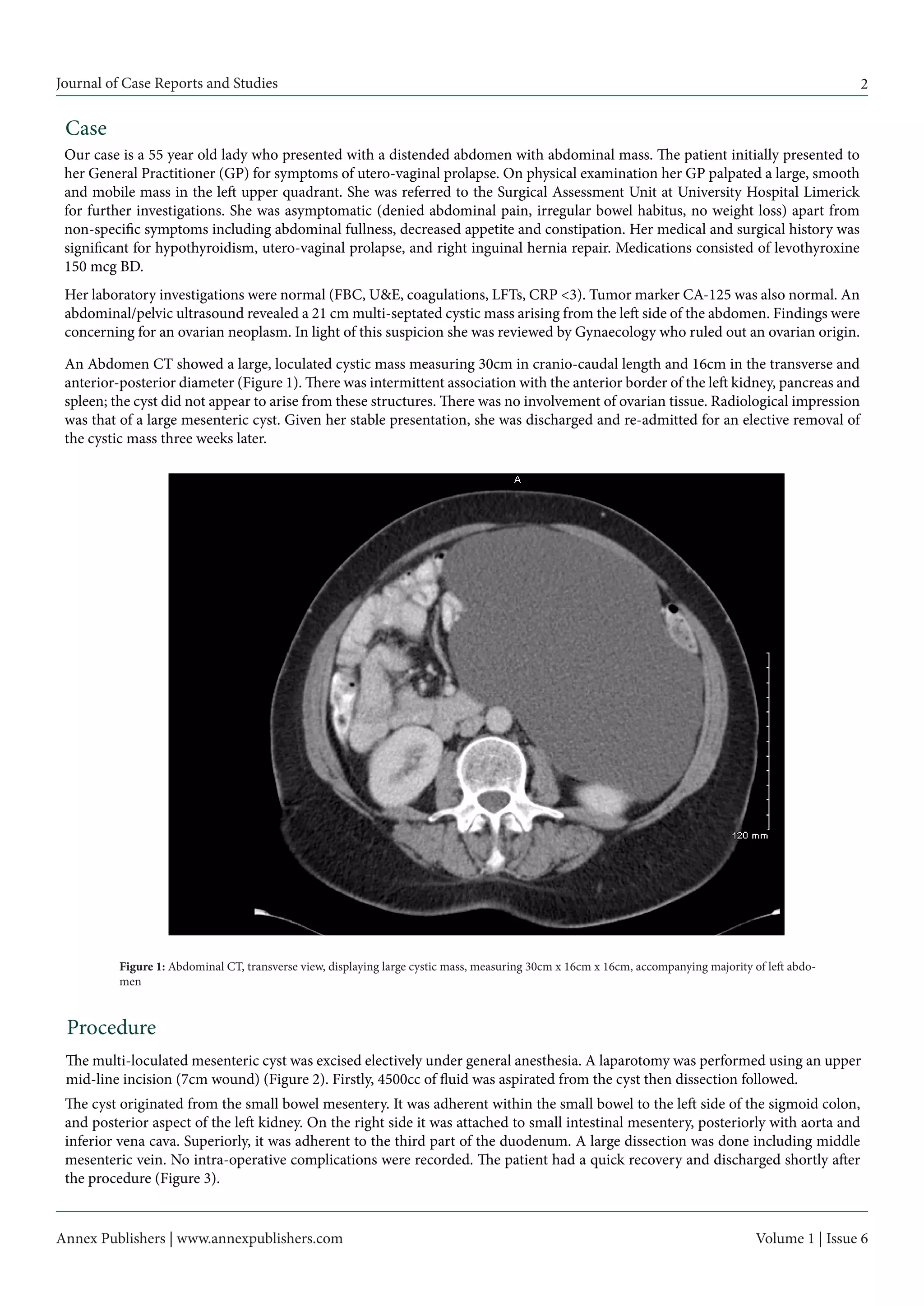 Giant mesenteric-cyst-cause-of-abdominal-distension-managed-with ...