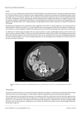 Giant mesenteric-cyst-cause-of-abdominal-distension-managed-with ...