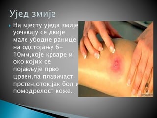 Ujed zmije i ubodi insekata | PPTX