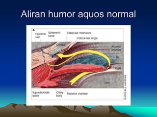 ujian glaukoma ppt tahun 2018:2019 atasnama Rahma noora | PPT