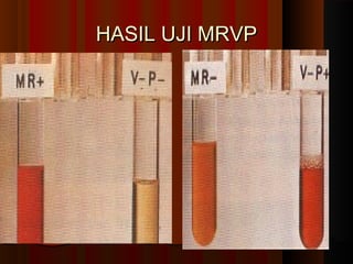 Uji biokimia konvensional dan rapid | PPT