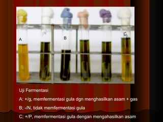 Uji biokimia konvensional dan rapid | PPT