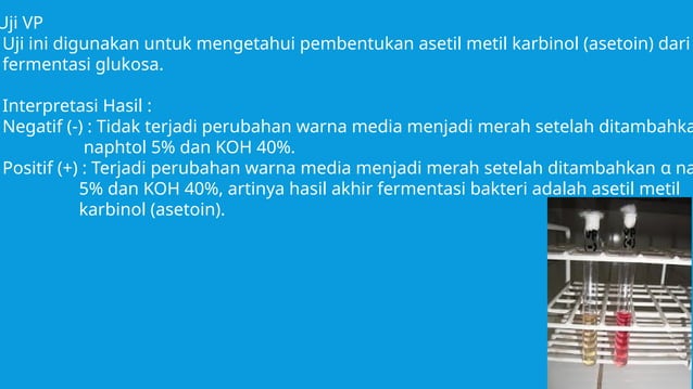 Uji Imvic untuk kelompok enterobacteriaceae | PPTX