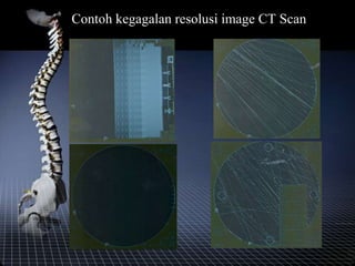 Uji kesesuaian ct scan | PPTX