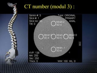 Uji kesesuaian ct scan | PPTX