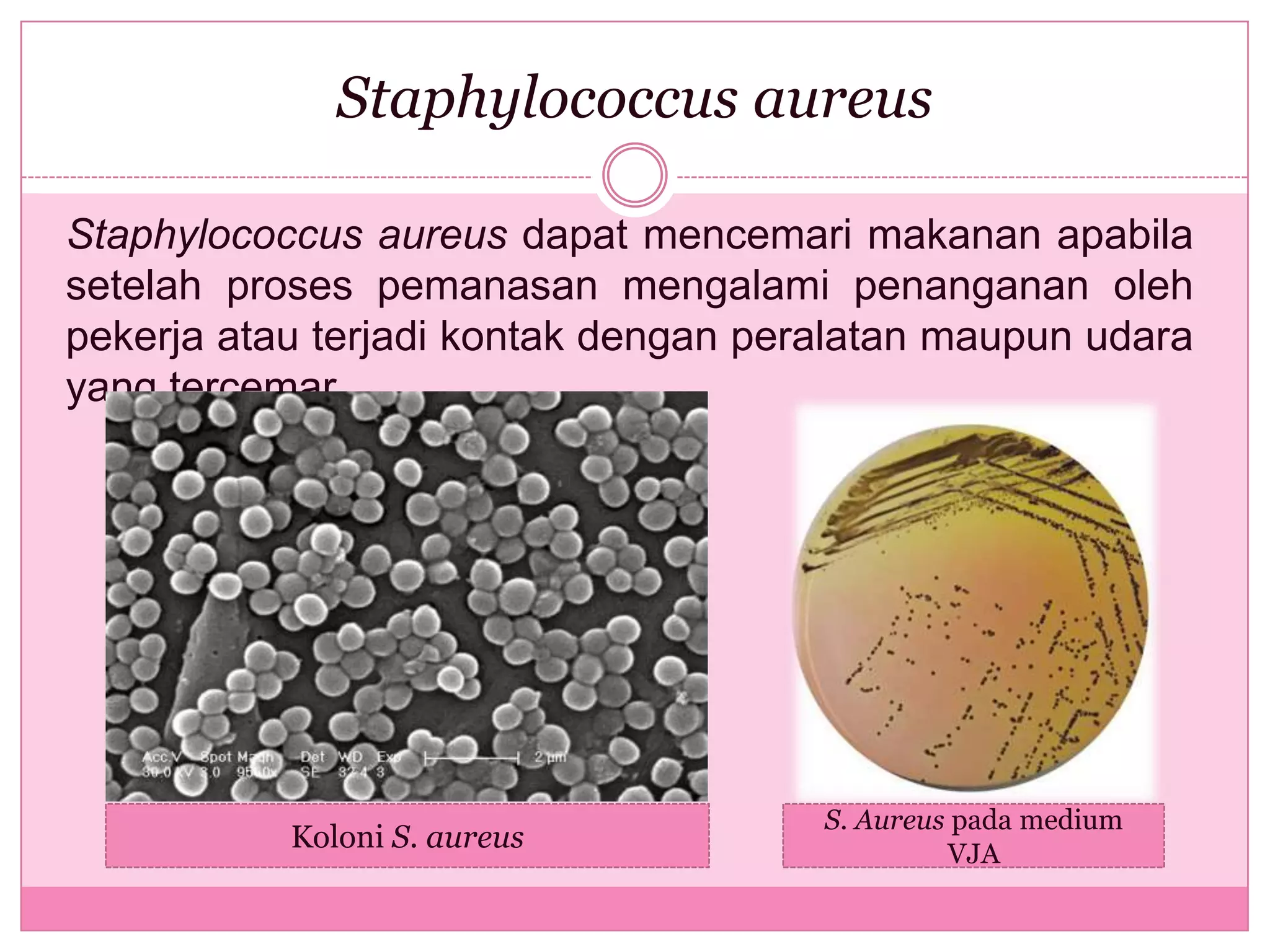 Uji mikrobiologis Makanan berlemak/minyak | PPTX
