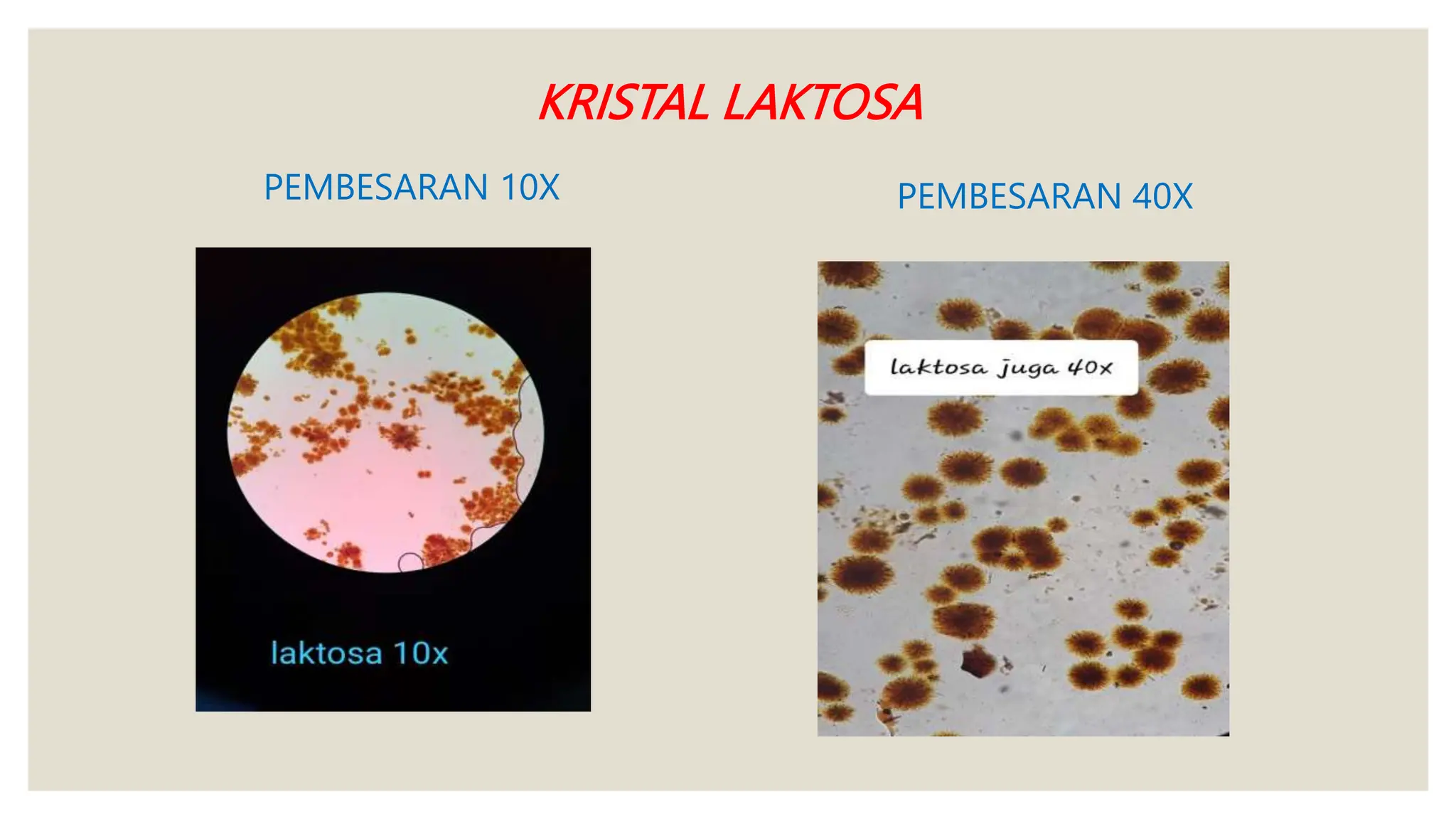 UJI OSAZON DAN KRISTAL KARBOHIDRAT UNTUK MENGETAHUI OSAZIN DAN KRISTAL ...