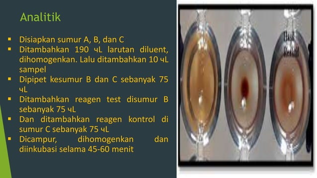 Uji tpha xi tlm | PPT