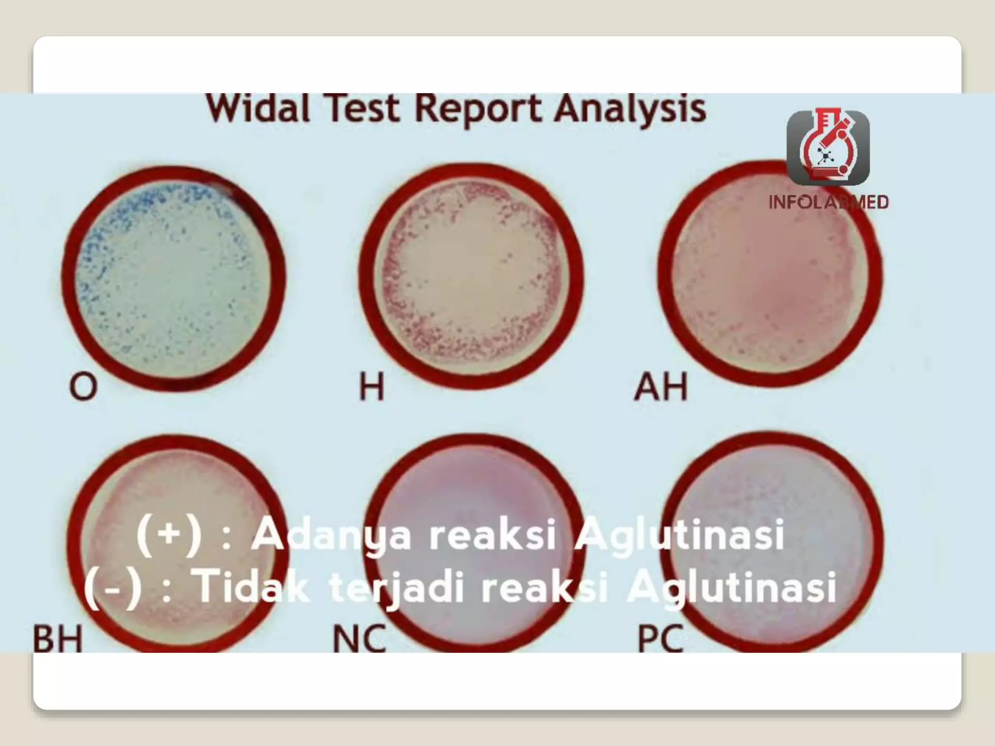Uji widal xi tlm | PPTX