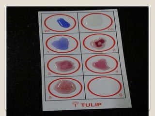 Uji widal xi tlm | PPT