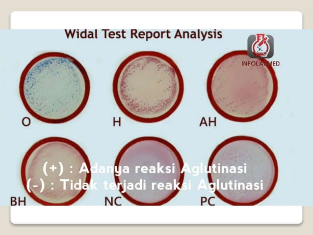 Uji widal xi tlm | PPT