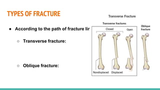 FRACTURE__ITS_MANAGEMENT.pptx
