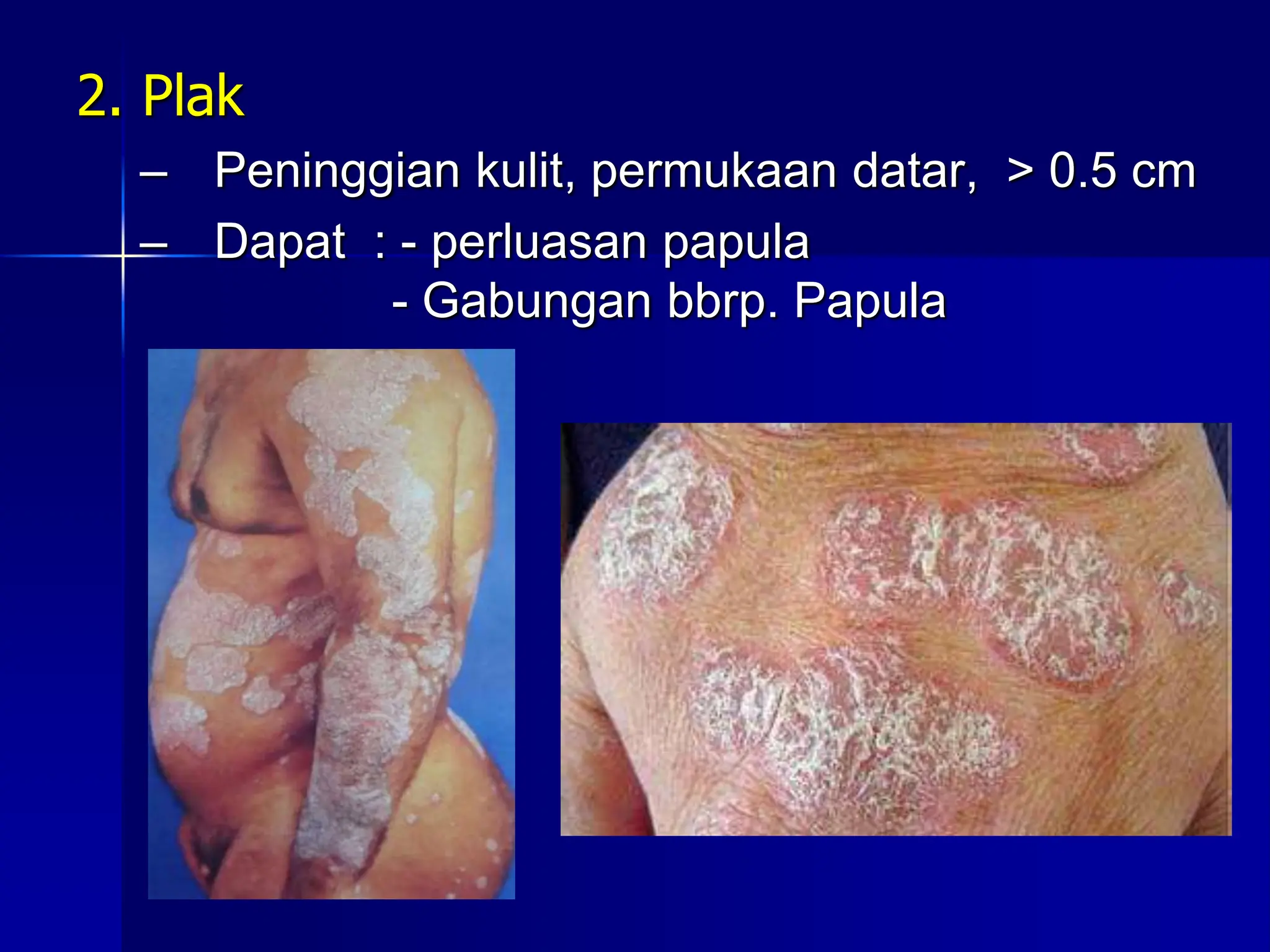 Ujud Kelainan Kulit.ppt