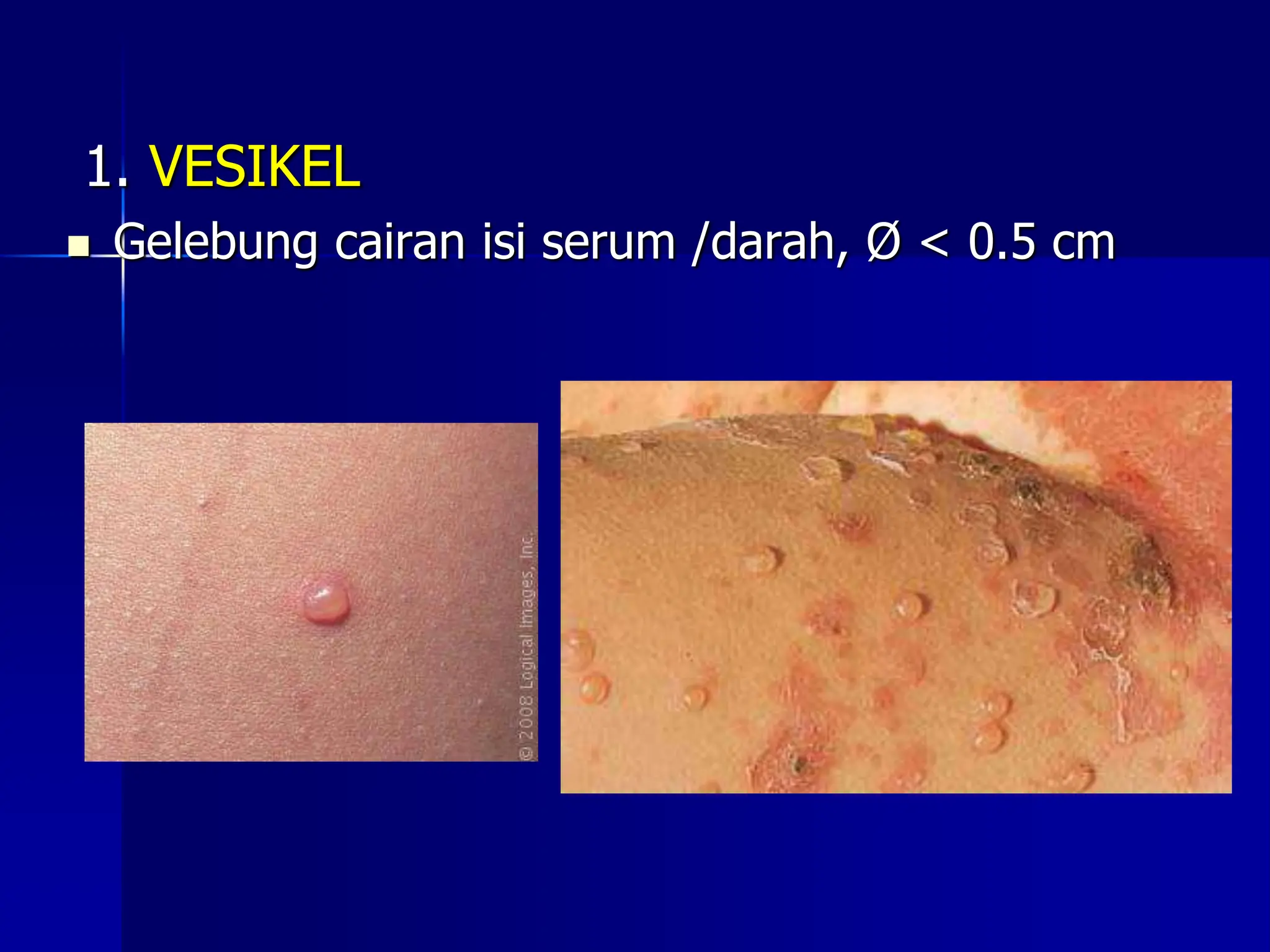 Ujud Kelainan Kulit.ppt