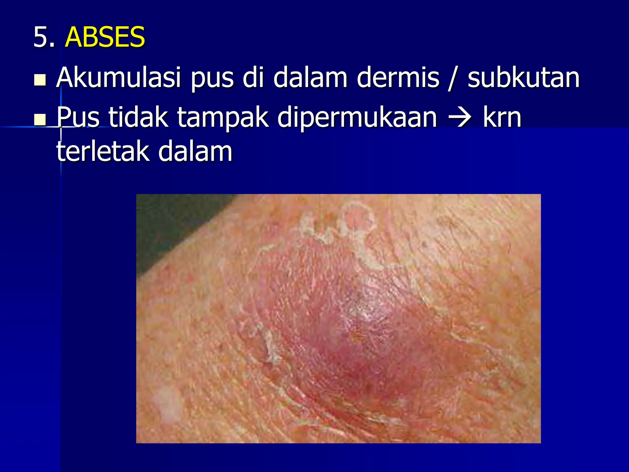 Ujud Kelainan Kulit.ppt